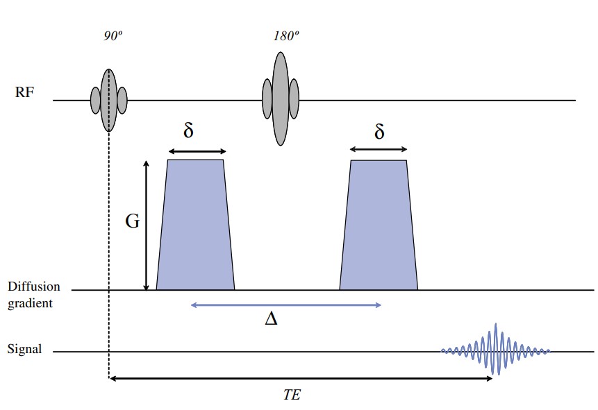 The Sounds of MRI | UCSF Larson Advanced Imaging Group